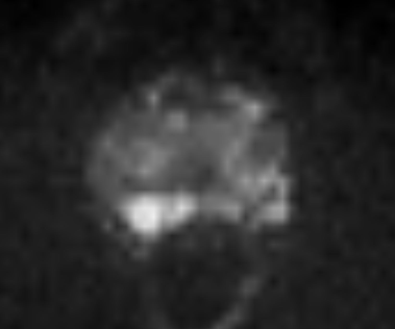 MRT_2diff - Das Radiologie Team